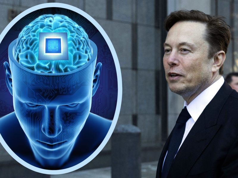 Musk-Start-up implantiert ersten Chip in menschlichem Gehirn - Welt ...